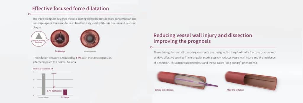 Scoring Balloon Catheter | Angeion Medical