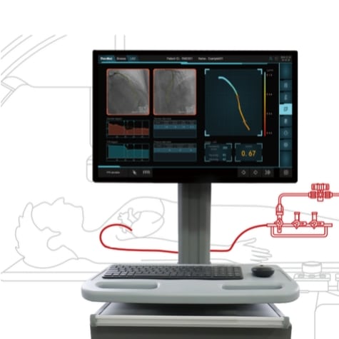 Fractional Flow Reserve (FFR) System | Angeion Medical