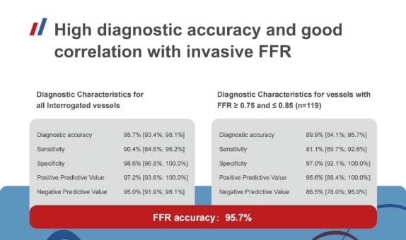 Fractional Flow Reserve (FFR) System | Angeion Medical