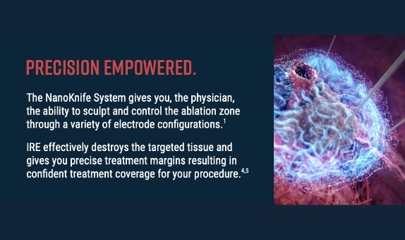 Irrevisible Electroporation (IRE) System | Angeion Medical