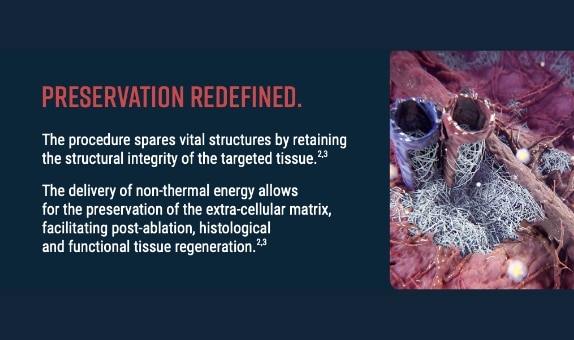 Irrevisible Electroporation (IRE) System | Angeion Medical