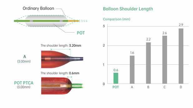 POT PTCA NC Balloon Catheter Launch | Angeion Medical